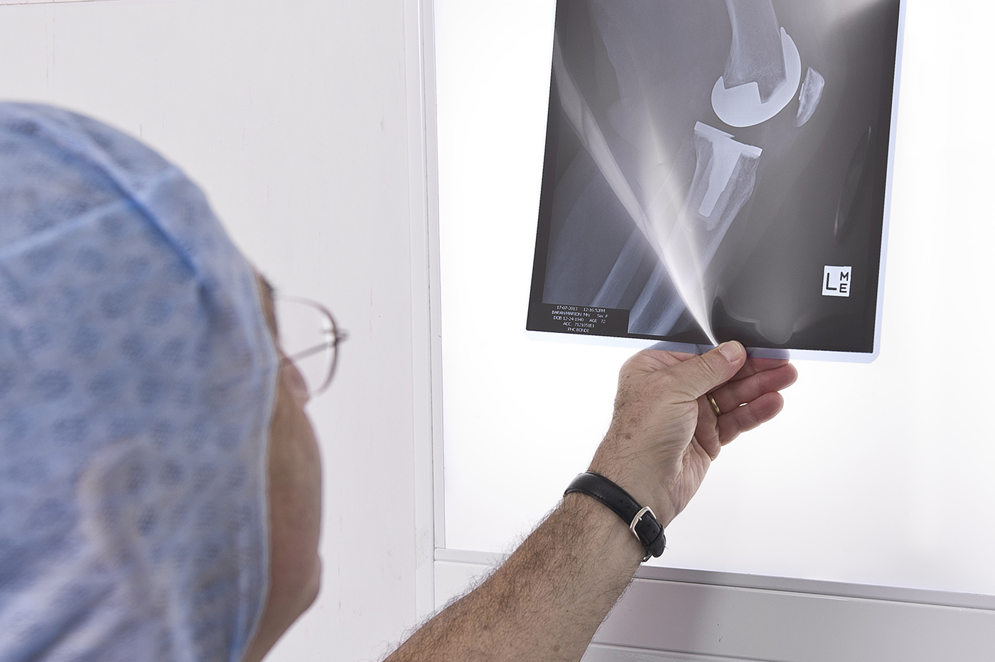 Prof Lawrence Kohan - Partial Knee Replacement Surgery